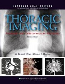 MBC | Thoracic Imaging, 2e, International Edition